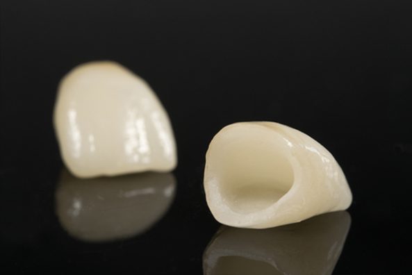 Dental Crowns Dental Crowns