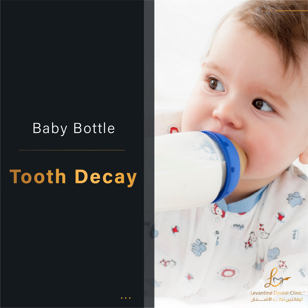 Preventing Baby Bottle Tooth Decay: A Comprehensive Guide