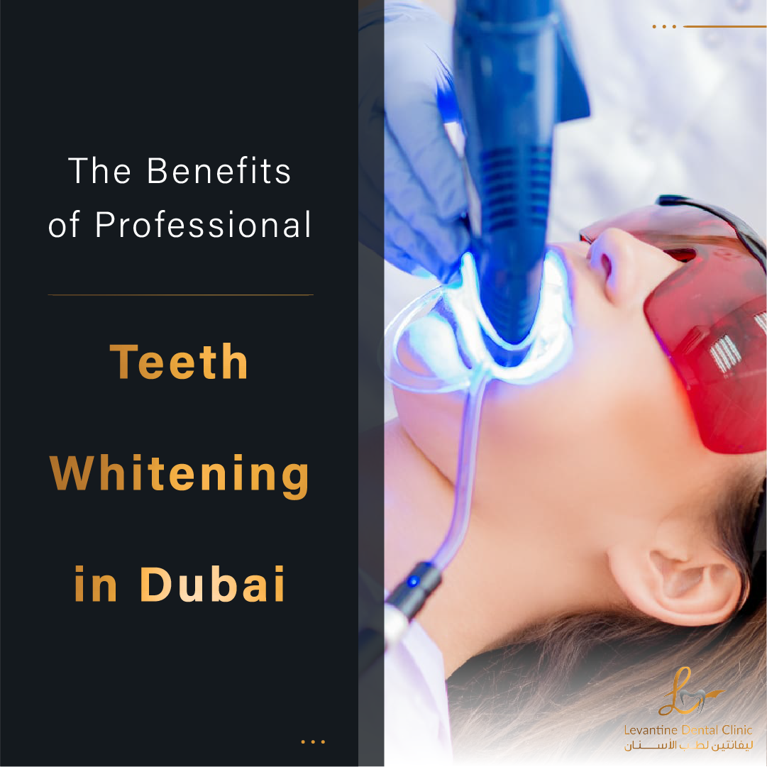 The Benefits Of Professional Teeth Whitening In Dubai: Enhance Your ...